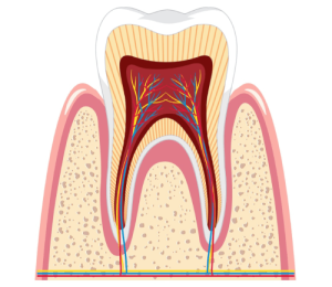 Root Canal Treatment - Penn Hill Dental Practice